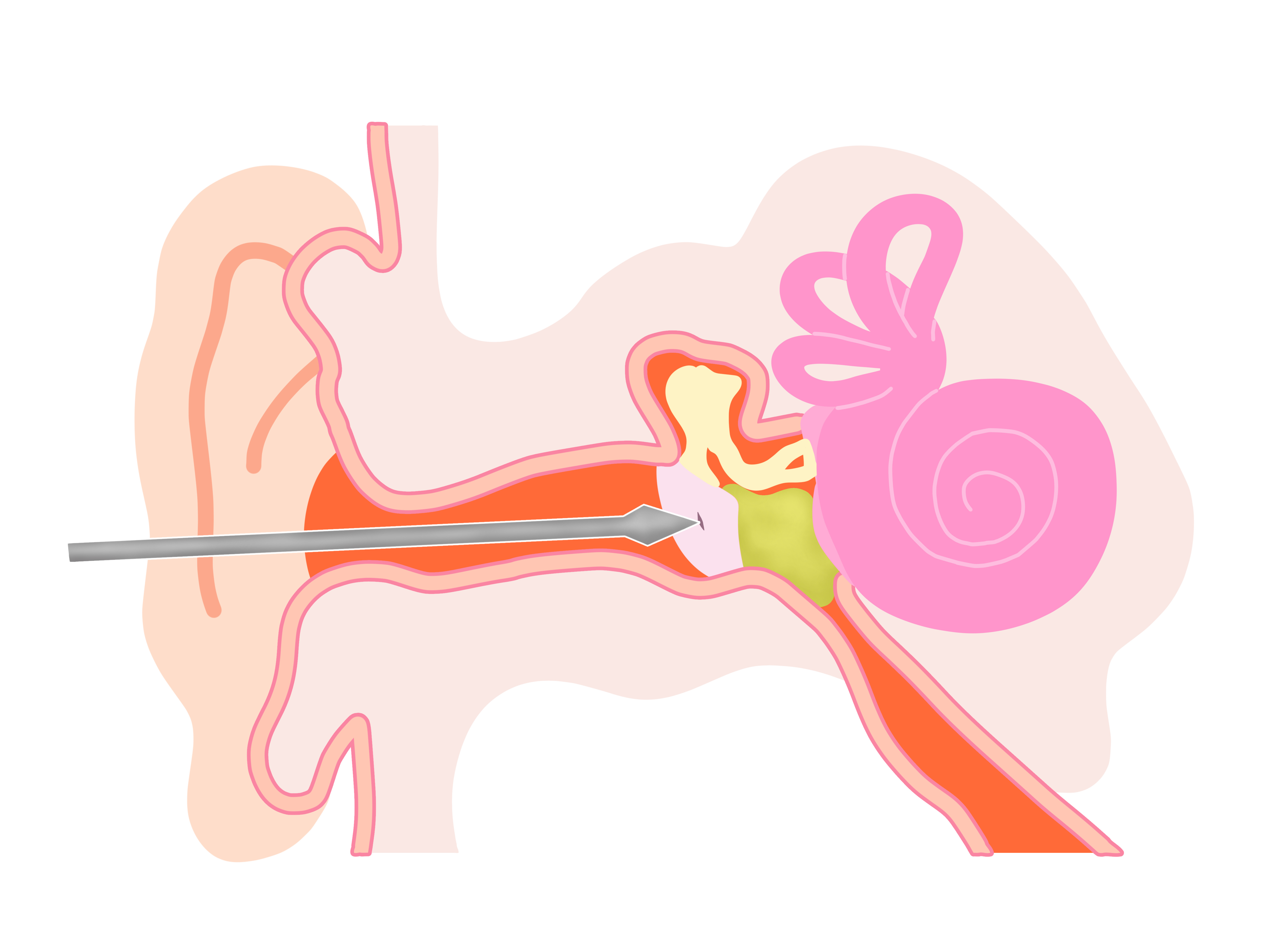 Comunidad MiMed Salud auditiva 28 de noviembre 2023